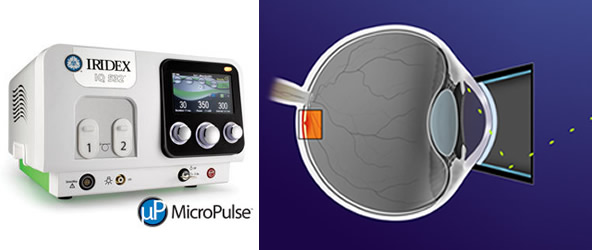 Glaucoma Surgery Northbrook | Glaucoma Treatment Skokie | Wyse Eye